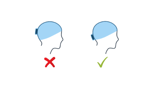 Triton Unit Placement