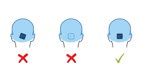 Triton Unit Placement